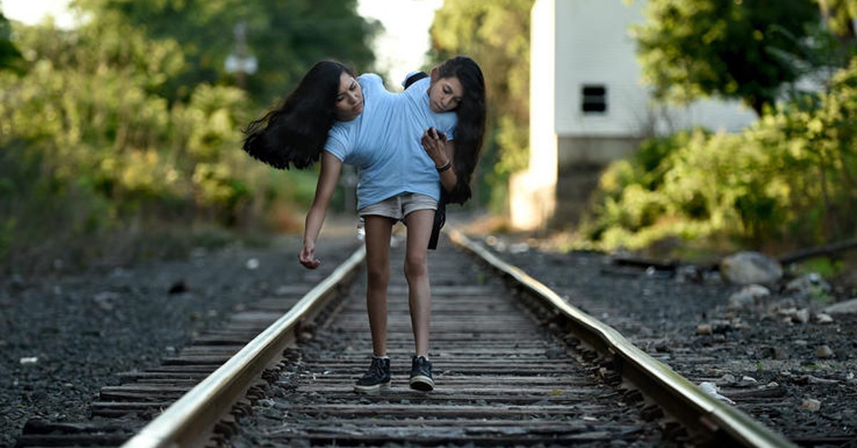 What 17 Year Old Conjoined Twins Carmen and Lupita Andrade Look Like ...