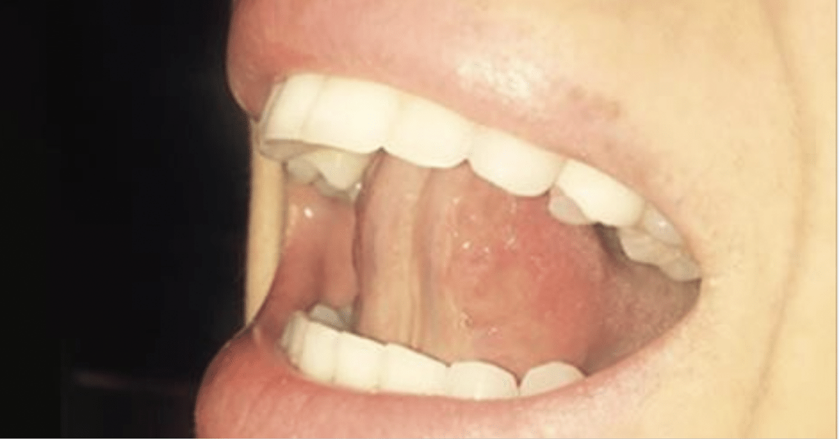 Touching The Roof Of Your Mouth With Your Tongue And Taking A Breath ...