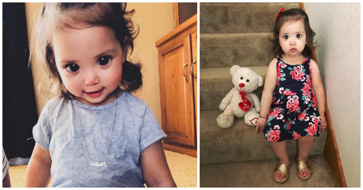 Toddler’s Big Eyes Resemble A Disney Princess, But They’re Due To A ...