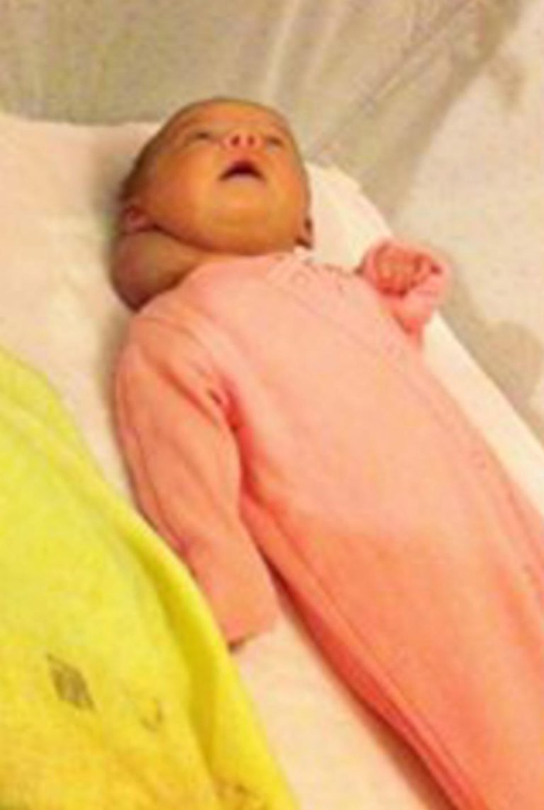 Baby born with strange lump on her neck, so mom snaps photo as it ...