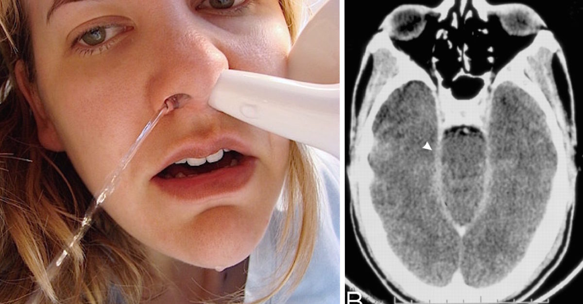 Seattle Woman Has Seizure And Passes Away From Using Neti Pot - Jesus Daily