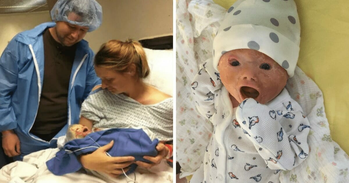 Doctors forced to do emergency C-section then stunned when baby has ...