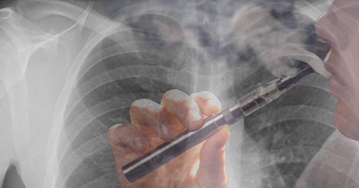Lung injuries being reported nationwide while people are vaping THC ...